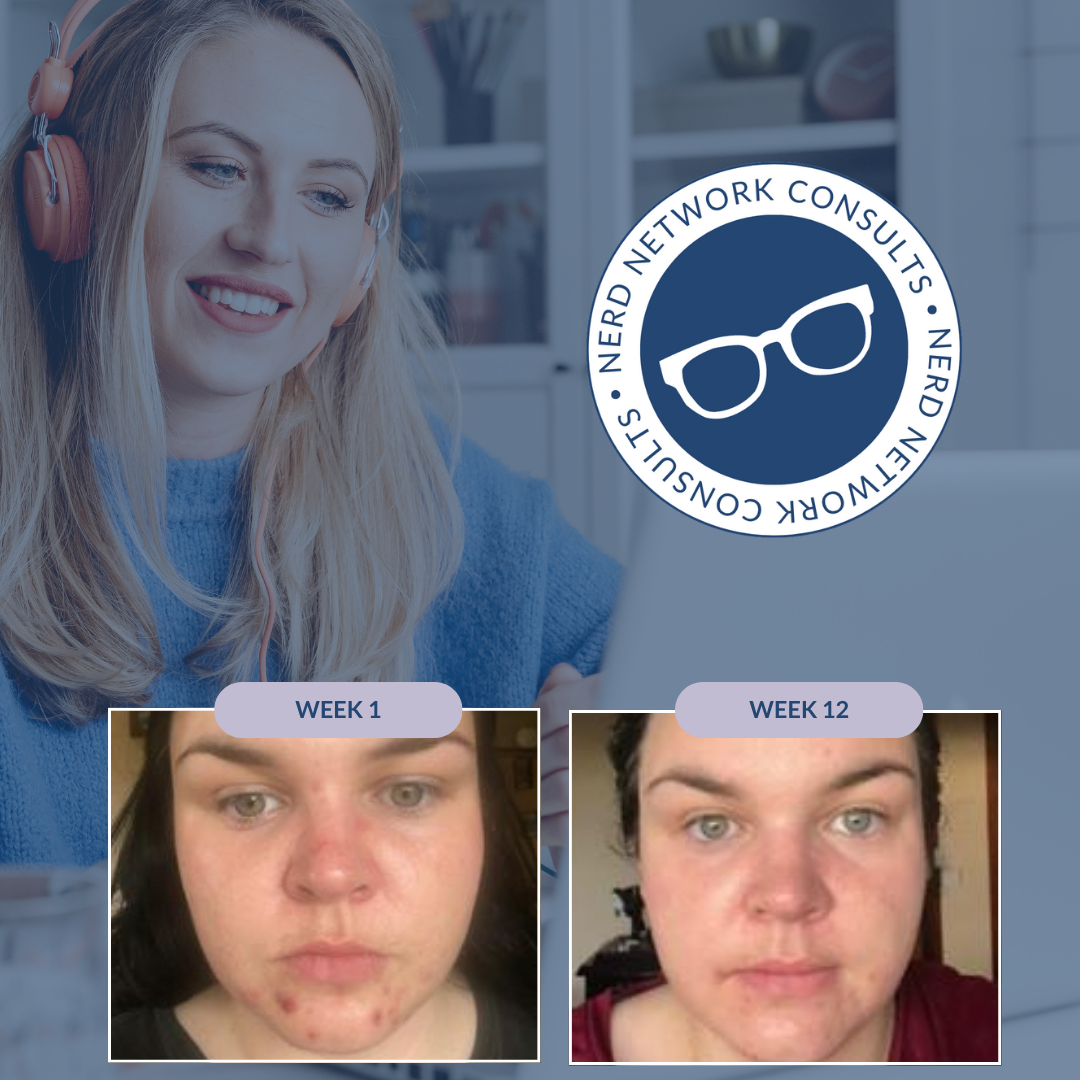 Jennifer Rock | The Skin Nerd | Online Skin Consultation